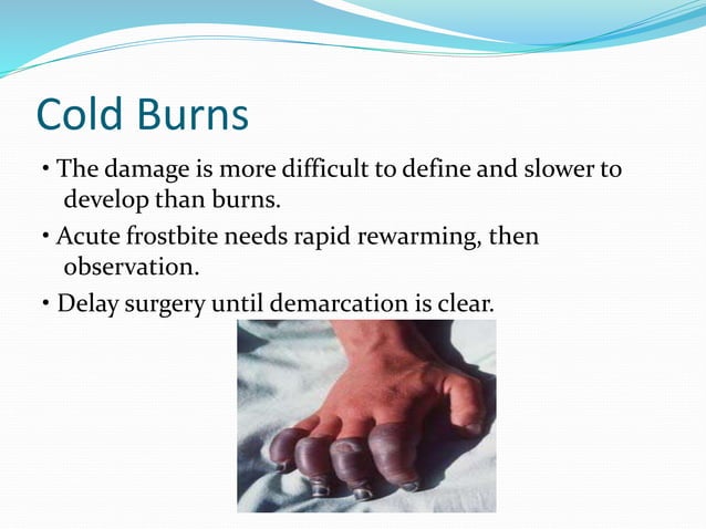 BURNS | PPTX