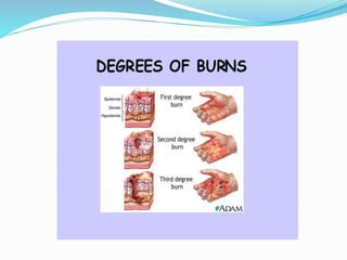 BURNS | PPTX