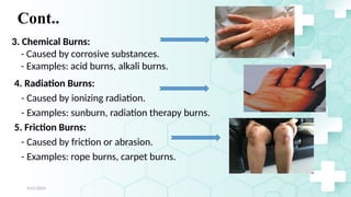 BURNS safe presentation for nursing .pptx