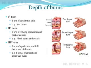 Burns & scalds | PDF | First Aid | Injuries