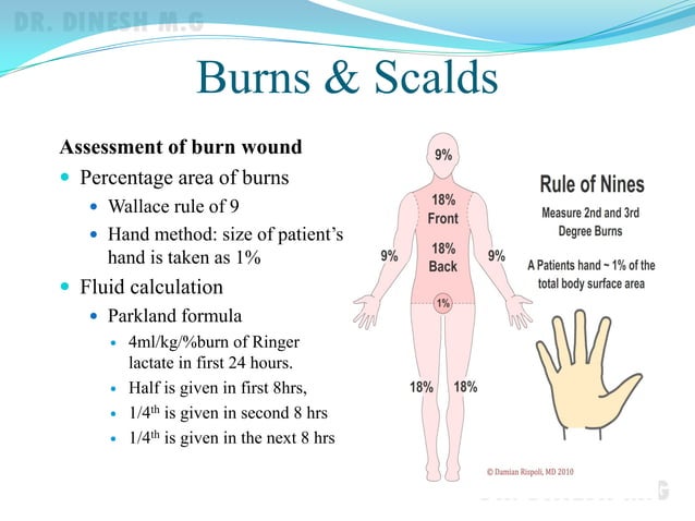 Burns & scalds
