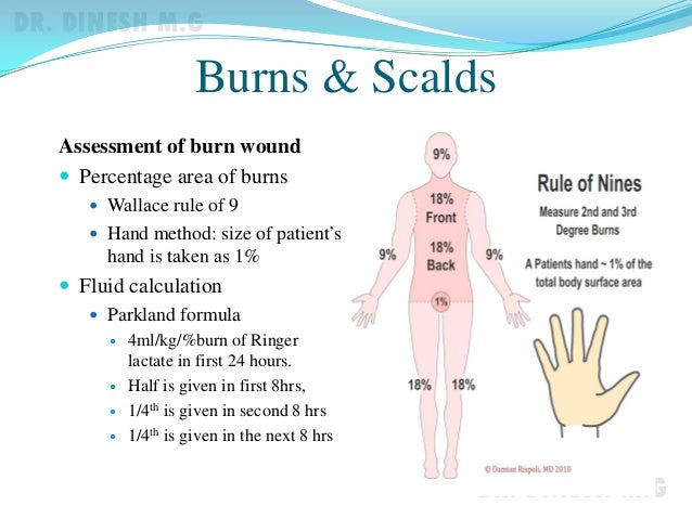 Burns & scalds