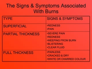 Burns | PPT