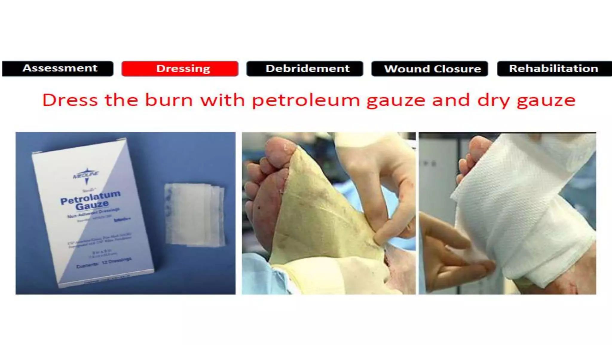 Burns surgical management | PPTX