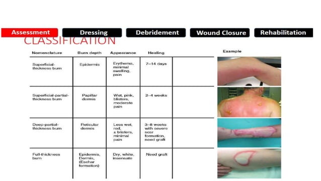 Burns surgical management | PPTX | First Aid | Injuries