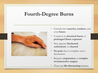 Burns and their types physiological changes.pptx