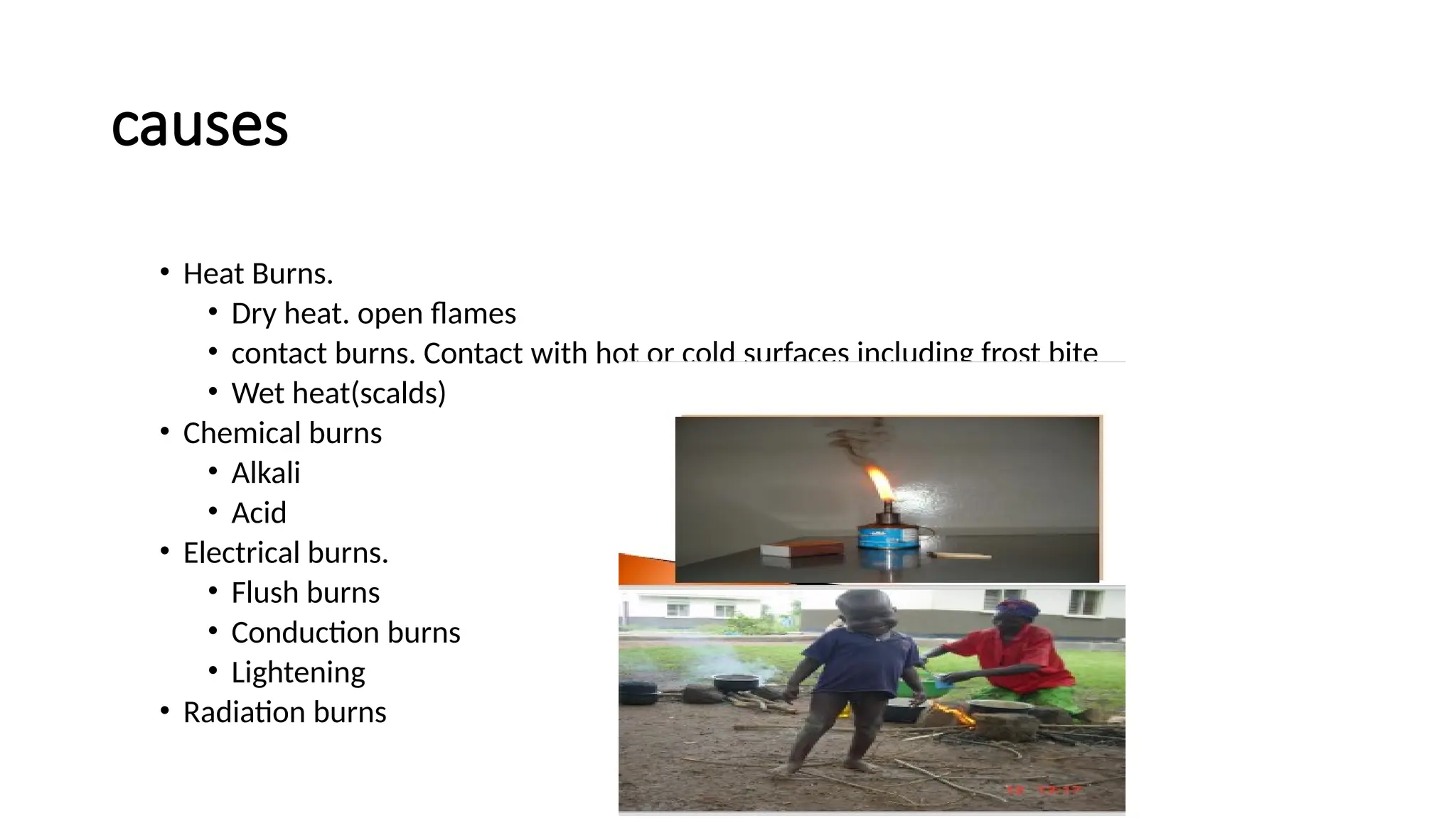 Burns_UPDATED34566467567544433334[1].pptx