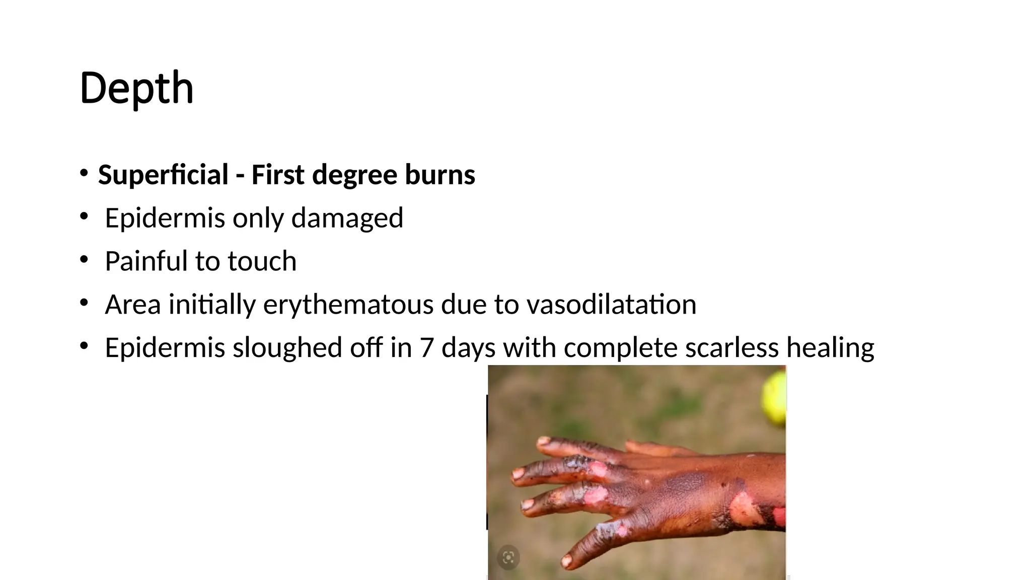 Burns_UPDATED34566467567544433334[1].pptx