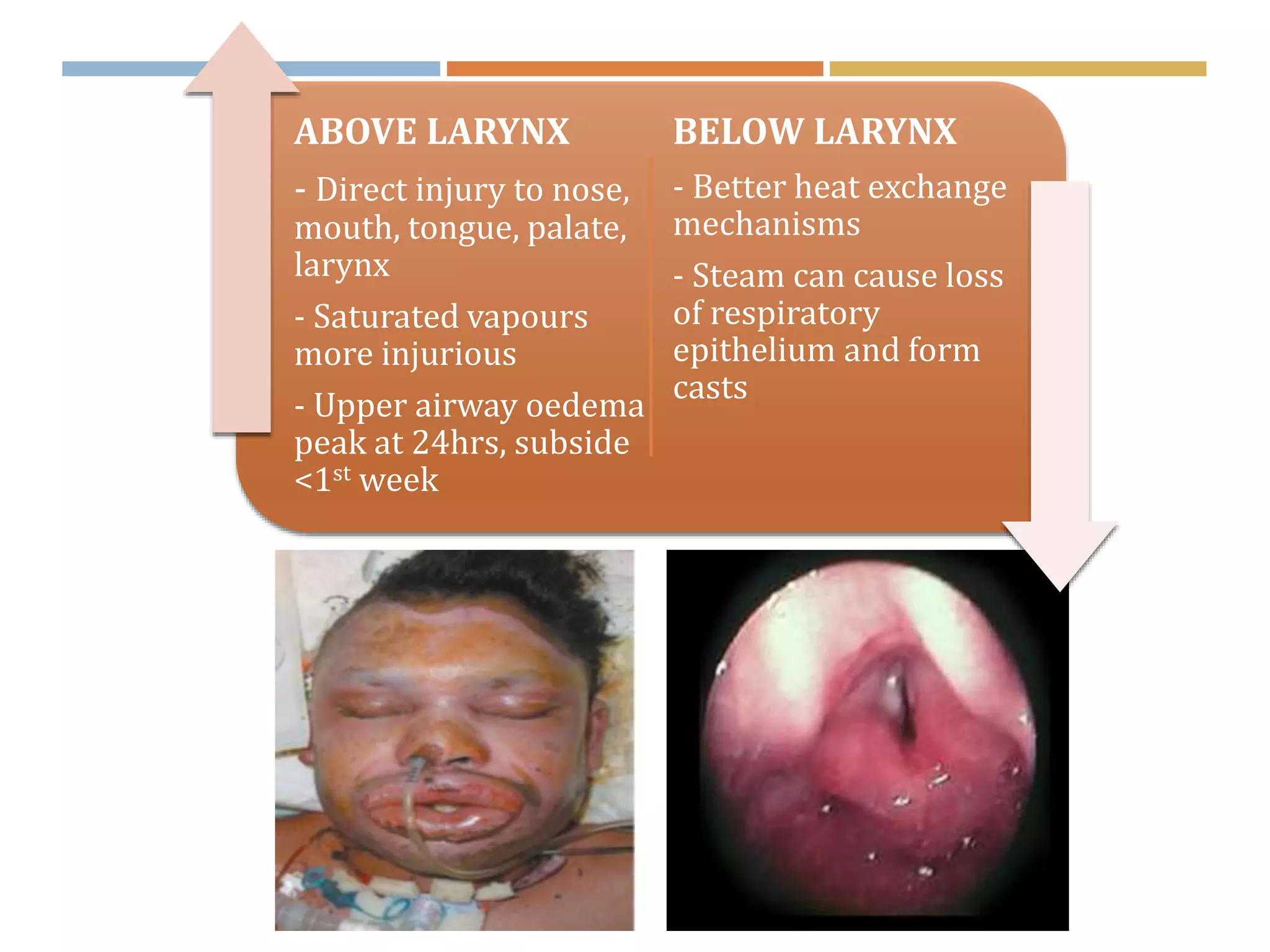 Anaesthetic management in a patient of burns injury | PPTX