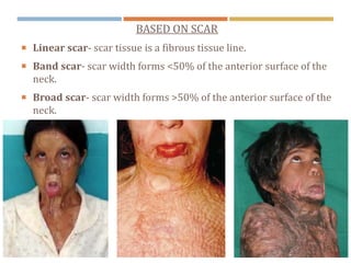Anaesthetic management in a patient of burns injury | PPTX