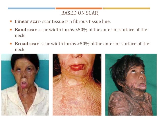 Anaesthetic management in a patient of burns injury | PPTX | First Aid ...