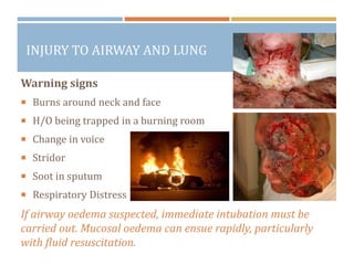 Anaesthetic management in a patient of burns injury | PPTX