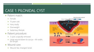 Burns, wounds, and physical therapy! | PPTX