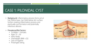 Burns, wounds, and physical therapy! | PPTX