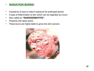 Burns, wounds & pressure sores | PPT