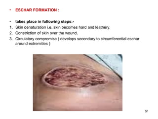 Burns, wounds & pressure sores | PPT