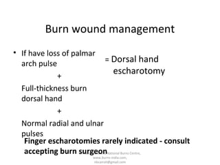 Burn update 2013 by Dr. Sunil Keswani, National Burns Centre, Airoli | PPT