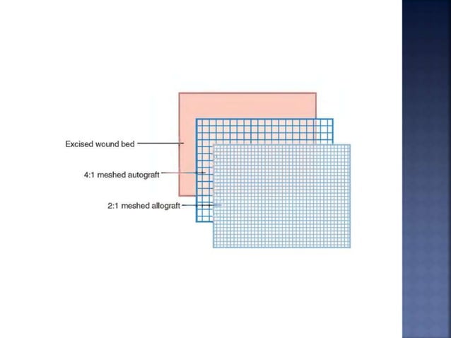 Burn wound management | PPTX | First Aid | Injuries