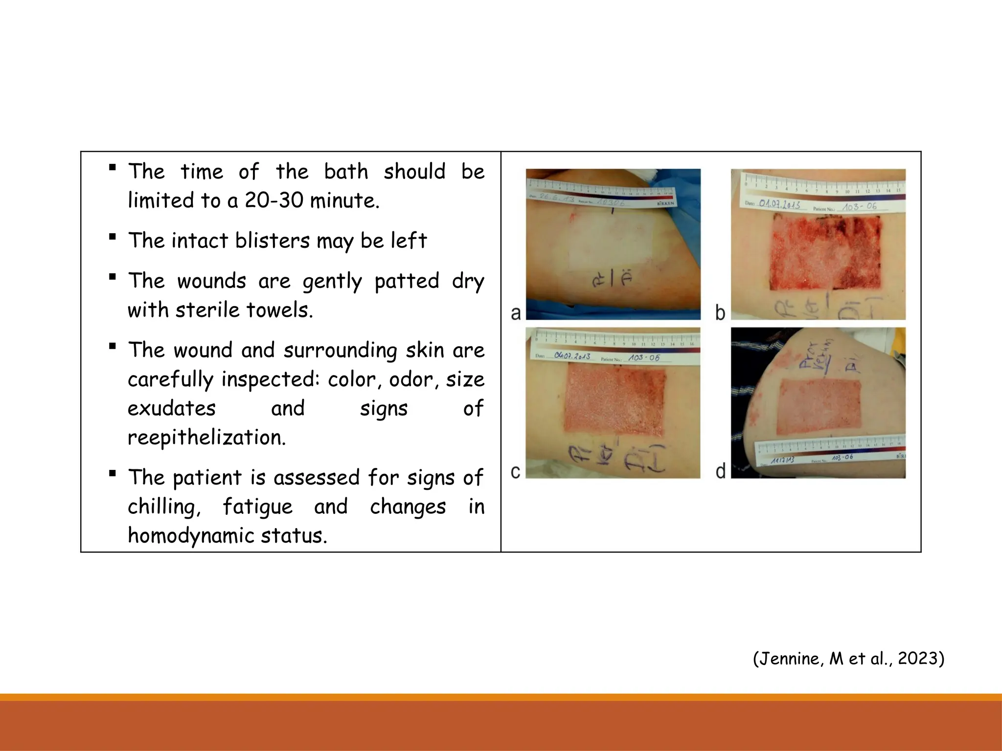 Burn Wound Management h2266995559999595999995959599 | PPT