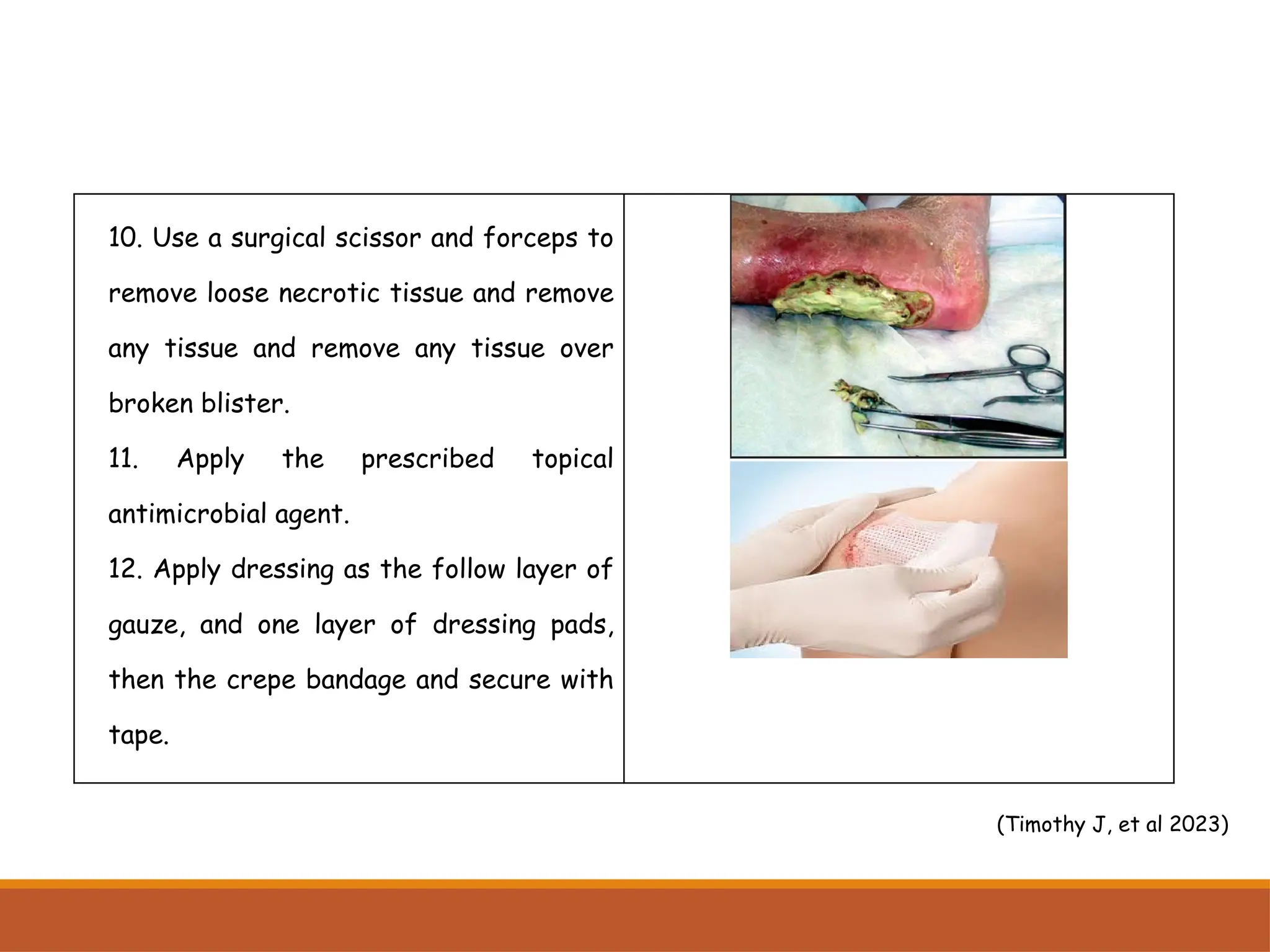 Burn Wound Management h2266995559999595999995959599 | PPT