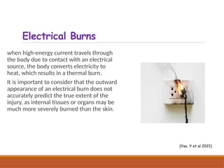 Burn Wound Management h2266995559999595999995959599 | PPTX