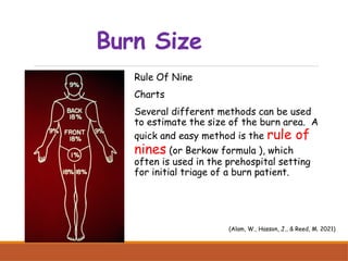 Burn Wound Management h2266995559999595999995959599 | PPTX