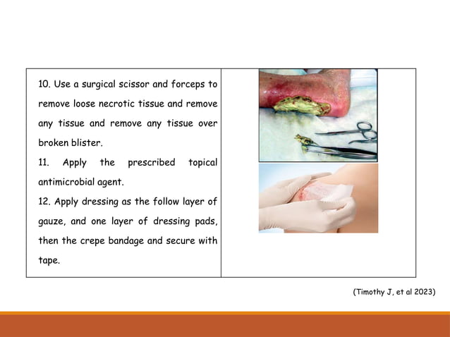 Burn Wound Management h2266995559999595999995959599 | PPT