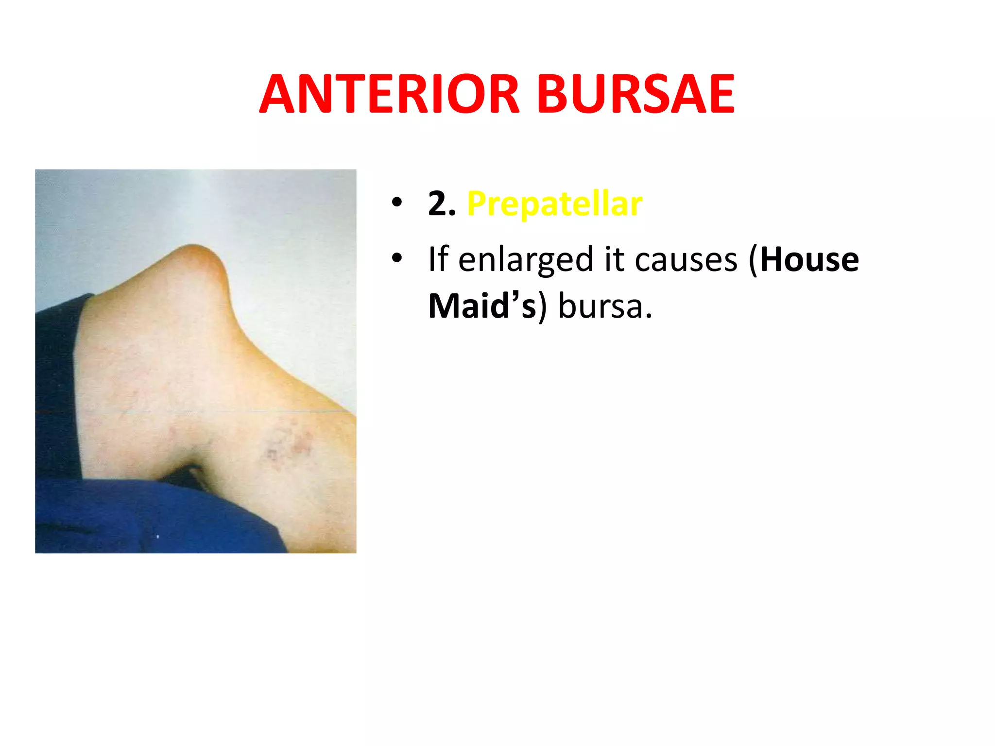 Bursae around knee joint | PPTX
