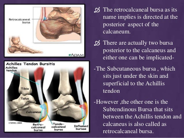 Bursare In Lower Extrimity