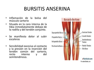 Bursitis | PPTX
