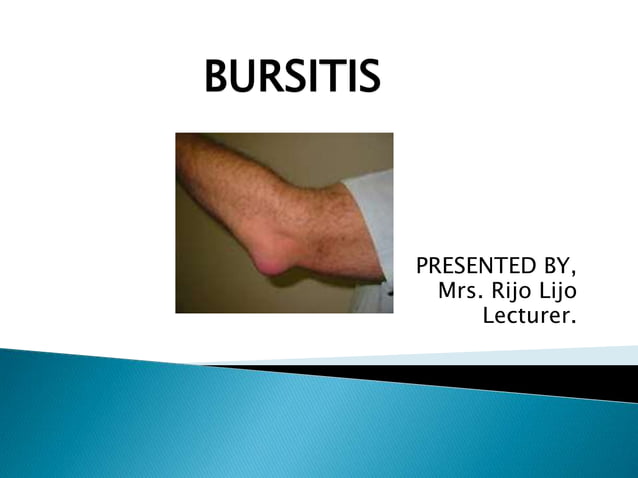 Bursitis | PPTX