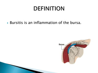 Bursitis | PPTX