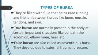 Bursitis | PPTX