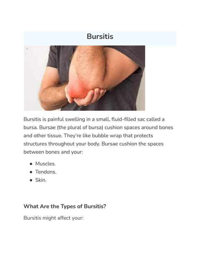 Bursitis.pdf