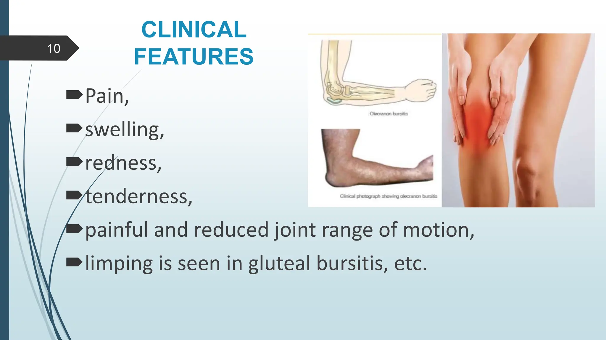 bursitisits treatment and nursing management .pptx