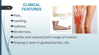 bursitisits treatment and nursing management .pptx