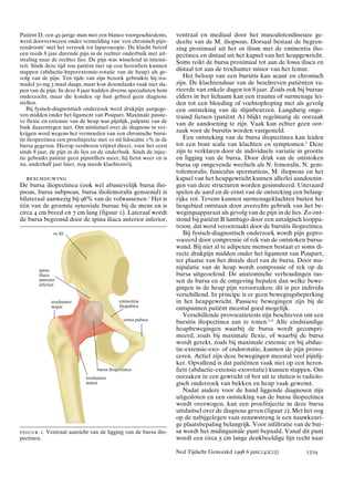 Bursitis iliopectinea | PDF