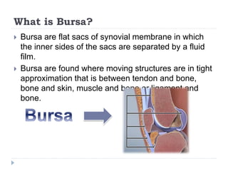 Bursitis | PPTX