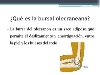 Bursitis Del Olecranon Codo y tratamiento.pptx
