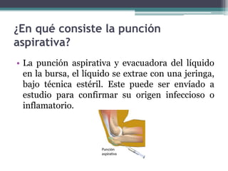Bursitis Del Olecranon Codo y tratamiento.pptx