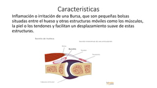 Bursitis mano | PDF