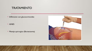Bursitis trocanterea/ Trocanteritis/ Bursitis trocanterica | PPTX