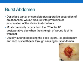 Burst abdomen | PPTX