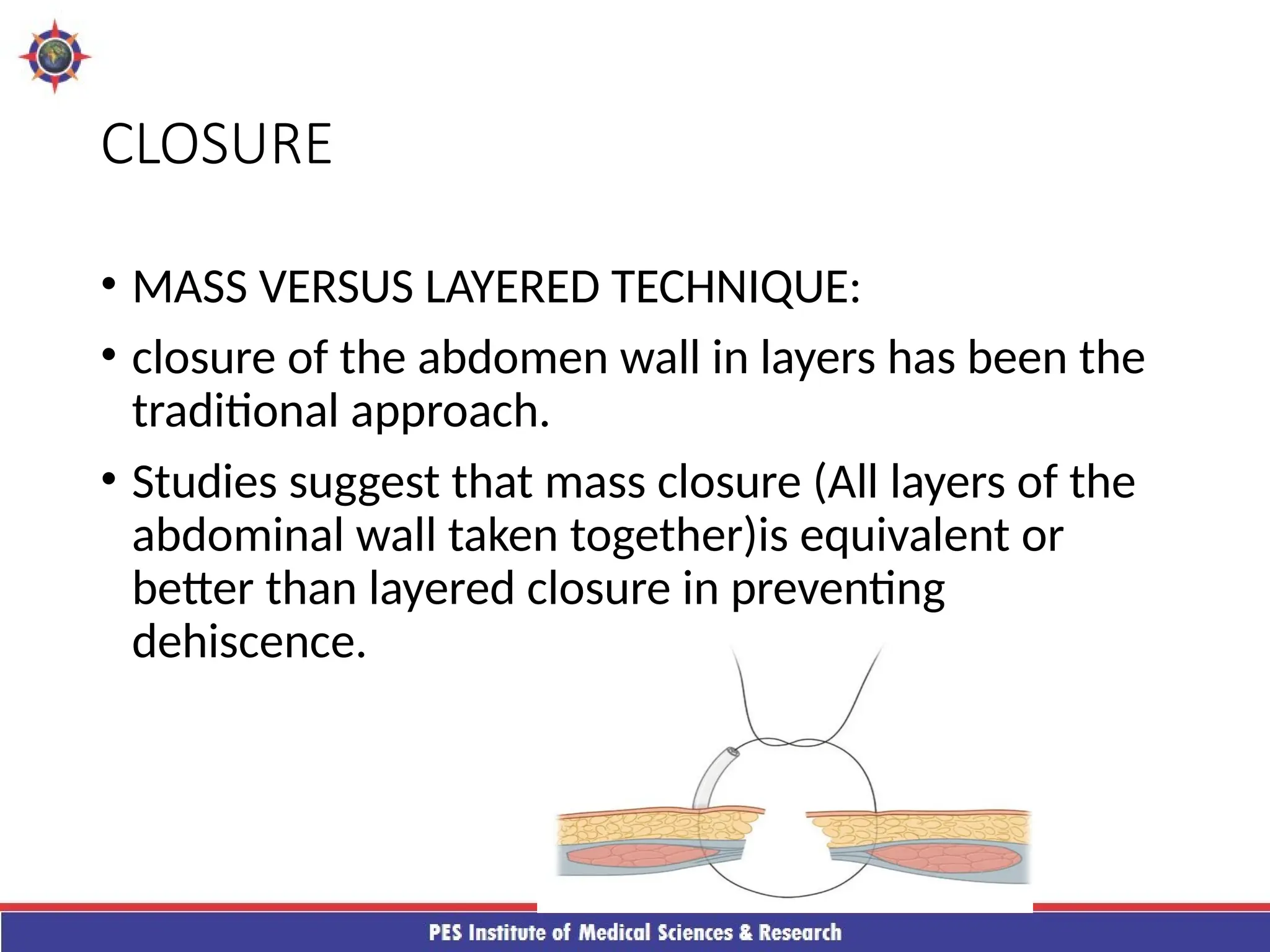 BURST ABDOMEN-etiology,management a.pptx
