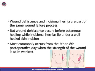 BURST ABDOMEN-etiology,management a.pptx