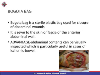 BURST ABDOMEN-etiology,management a.pptx