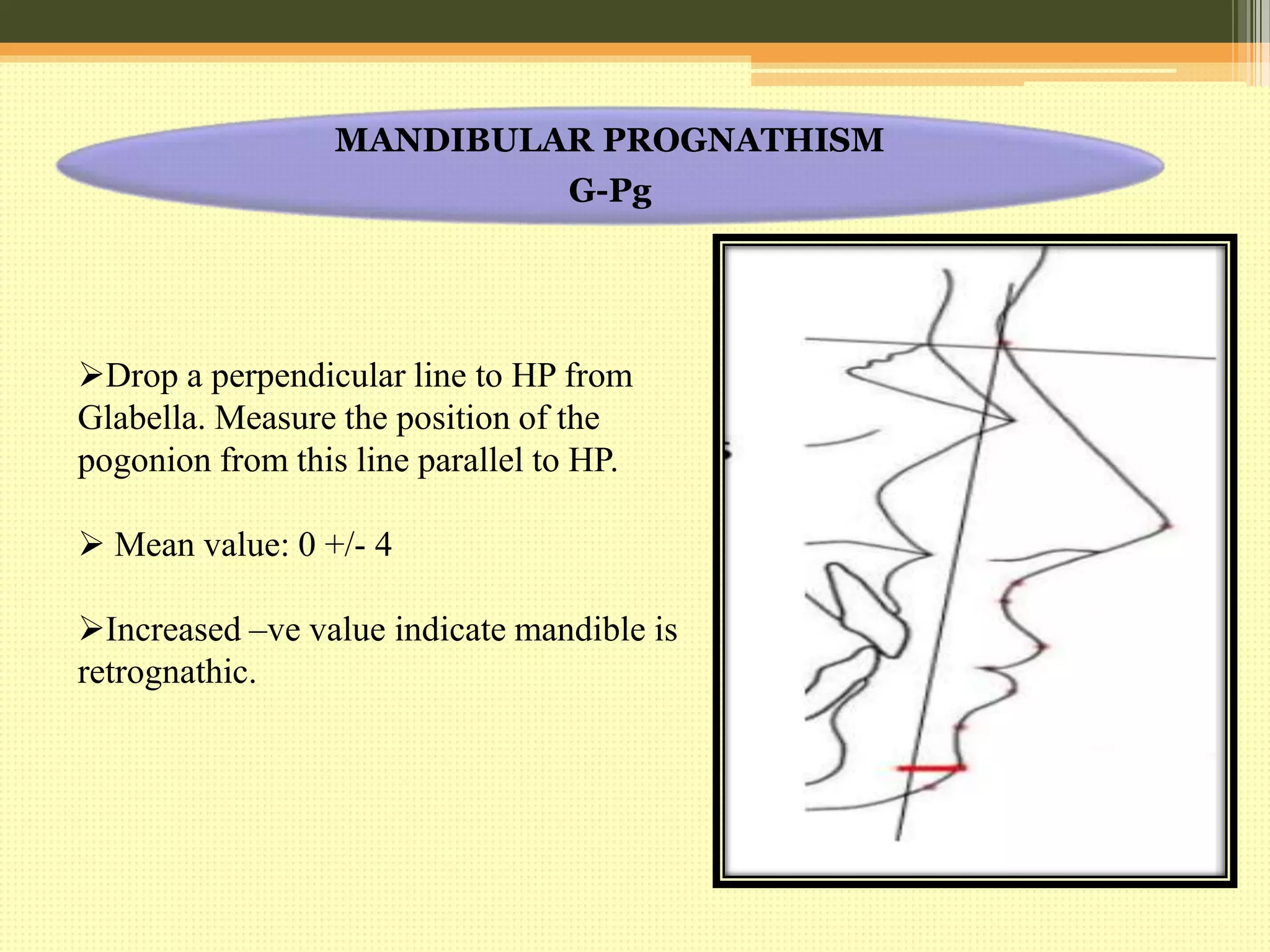 BURSTONE ANALYSIS : C.O.G.S ( HARD & SOFT TISSUE) | PPTX