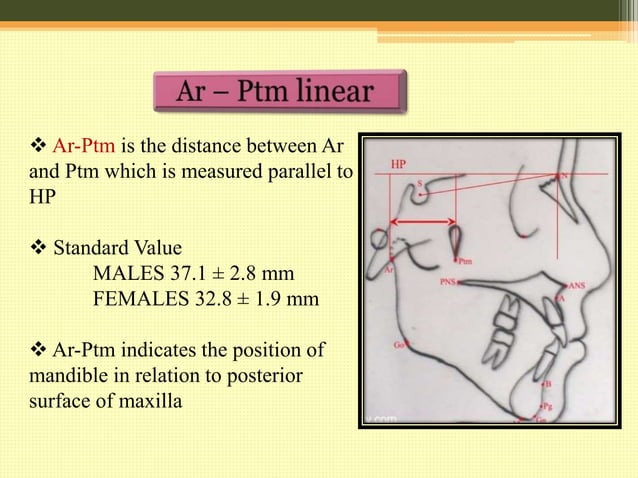 BURSTONE ANALYSIS : C.O.G.S ( HARD & SOFT TISSUE) | PPTX | Dental ...