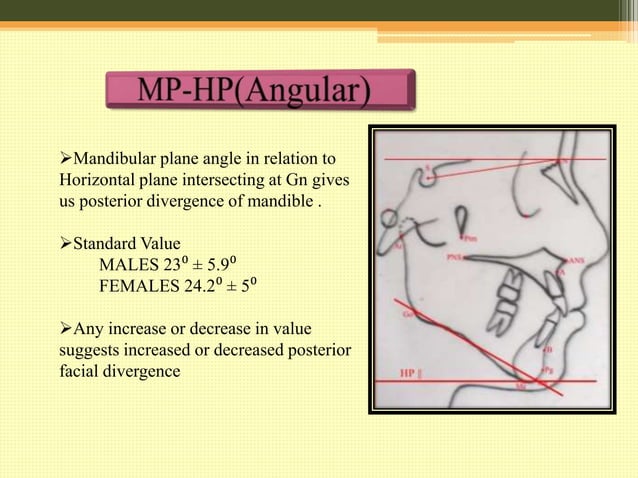 BURSTONE ANALYSIS : C.O.G.S ( HARD & SOFT TISSUE) | PPTX | Dental ...