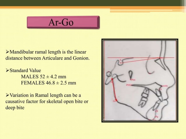 BURSTONE ANALYSIS : C.O.G.S ( HARD & SOFT TISSUE) | PPTX | Dental ...